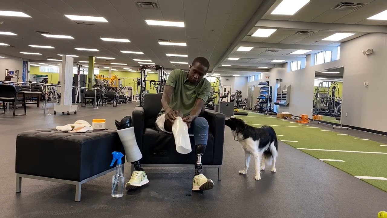 BK Prosthesis Donning Demonstration - Supraflex system - YouTube