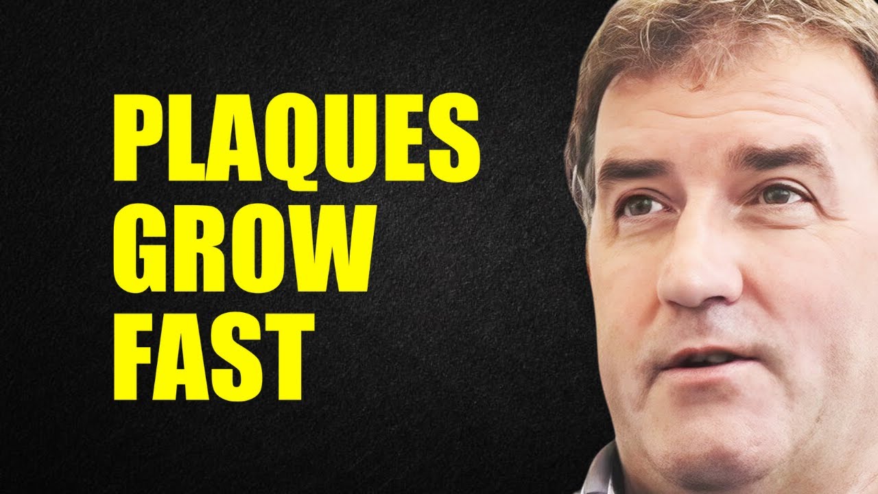 Dr. Kendrick Reveals Shocking Truth: Rapid Plaque Growth in Arteries ...