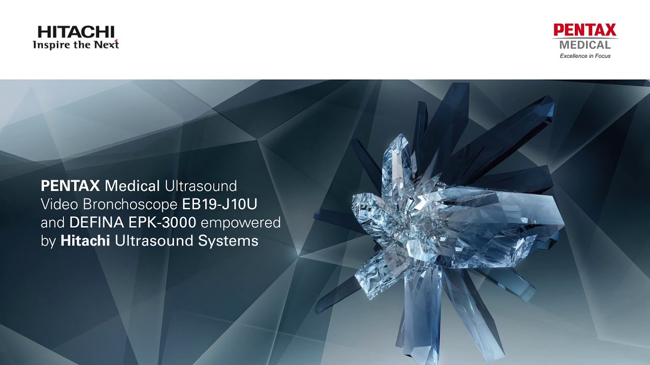 EB19 J10U EPK 3000 empowered by HITACHI Ultrasound Systems - YouTube