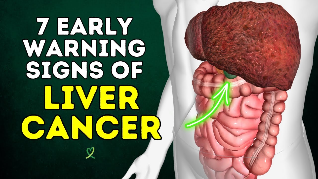 7 Early Warning Signs of Liver Cancer - YouTube