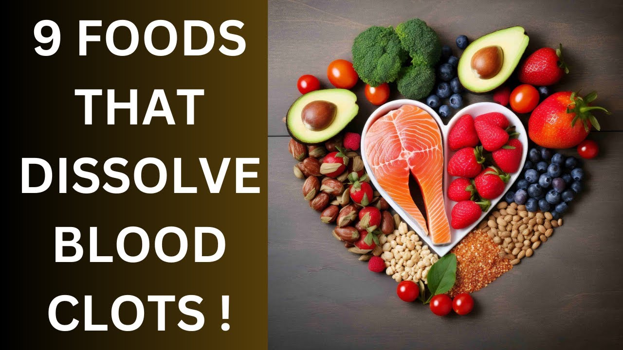 You Need To Eat These 9 Foods That HELP DISSOLVE Blood Clots !! - YouTube