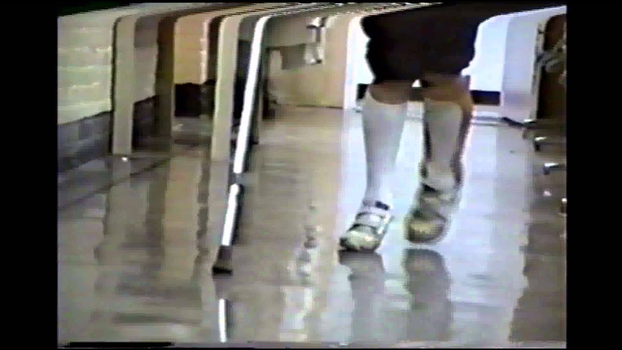 DAAJ AFO Brace Coronal - YouTube