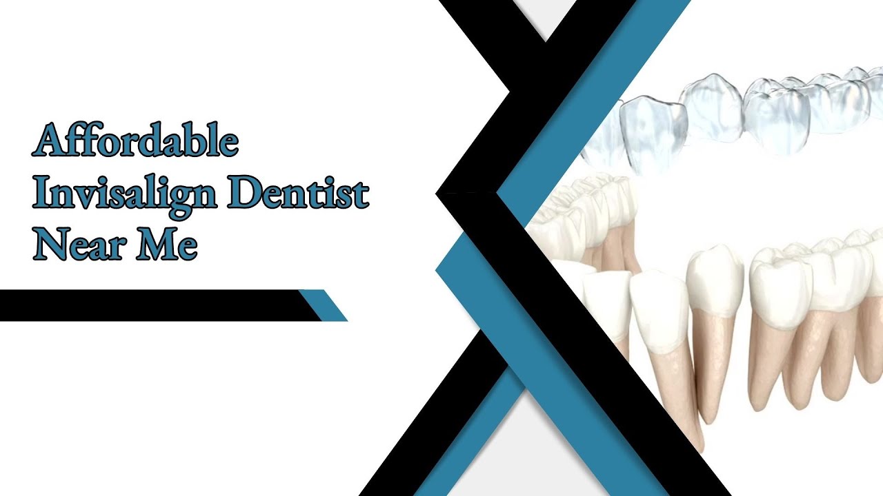 Affordable Invisalign Dentist Near Me - YouTube