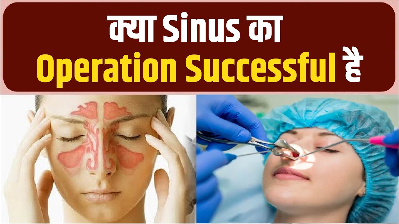 क्या Sinus का Operation Successful होता है? | What are benefits and ...