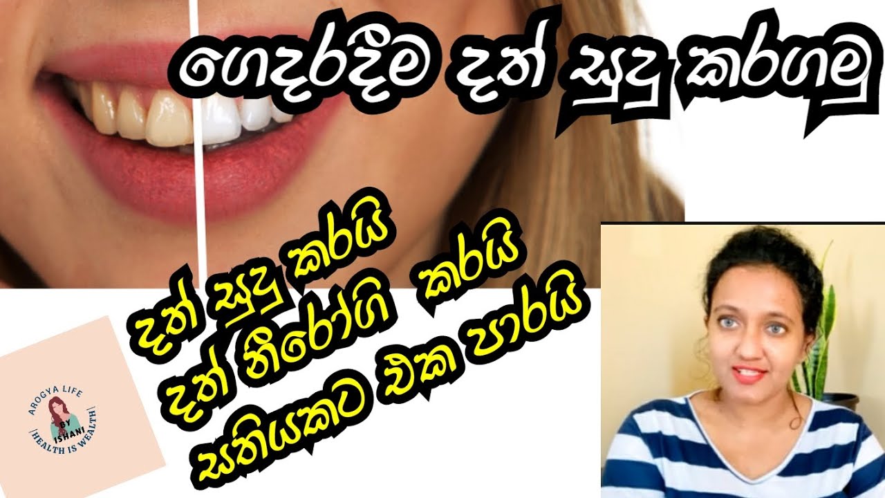 දත් සුදු කරන නීරෝගී කරන ප්‍රතිකාරය|teeth whitening home remedy|teeth ...