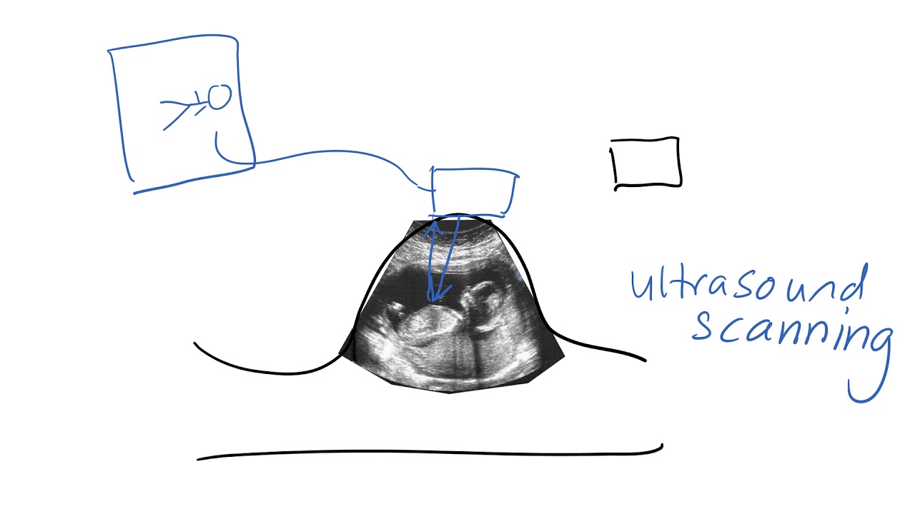 Application of echo - YouTube