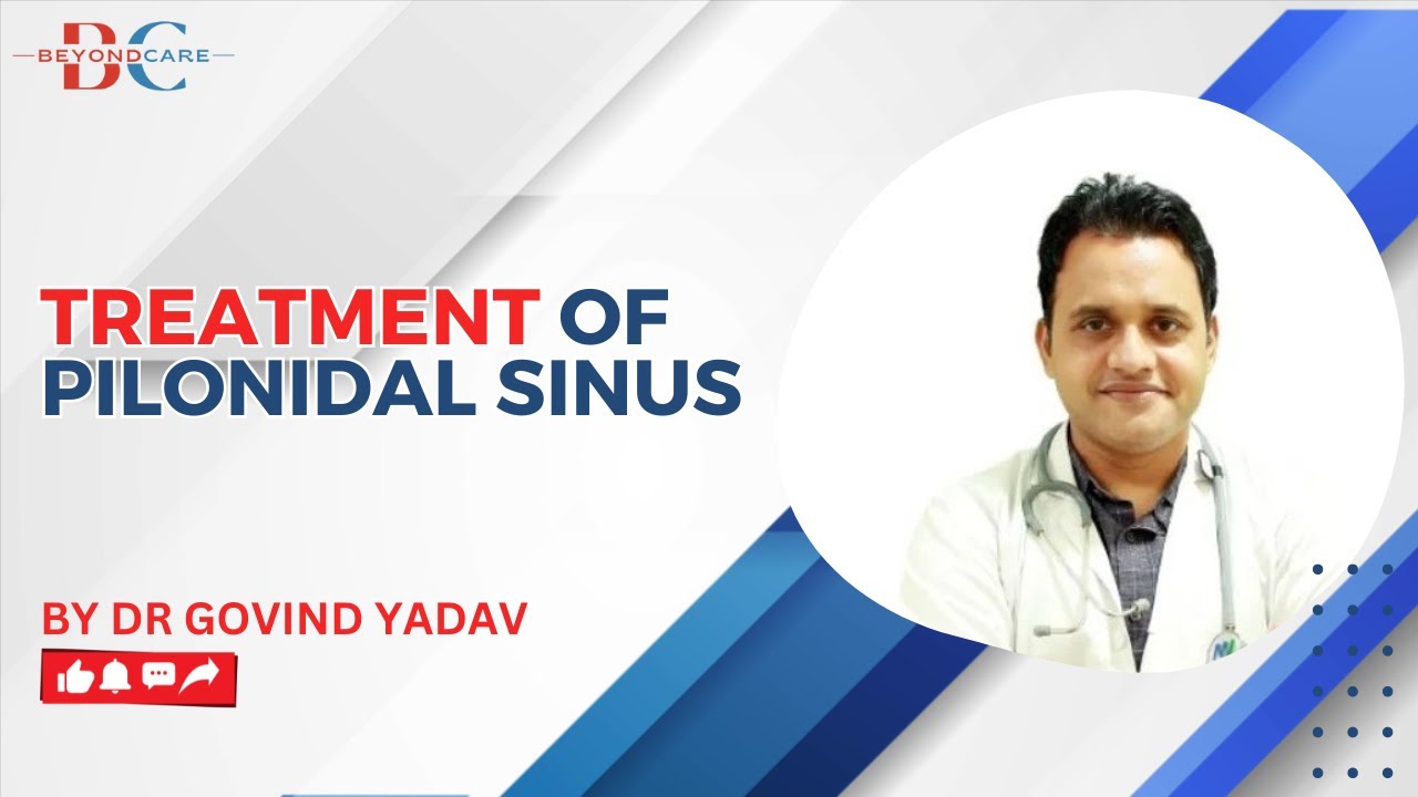 Treatment of Pilonidal sinus/ Pilonidal abscess/ Pilonidal cyst - YouTube