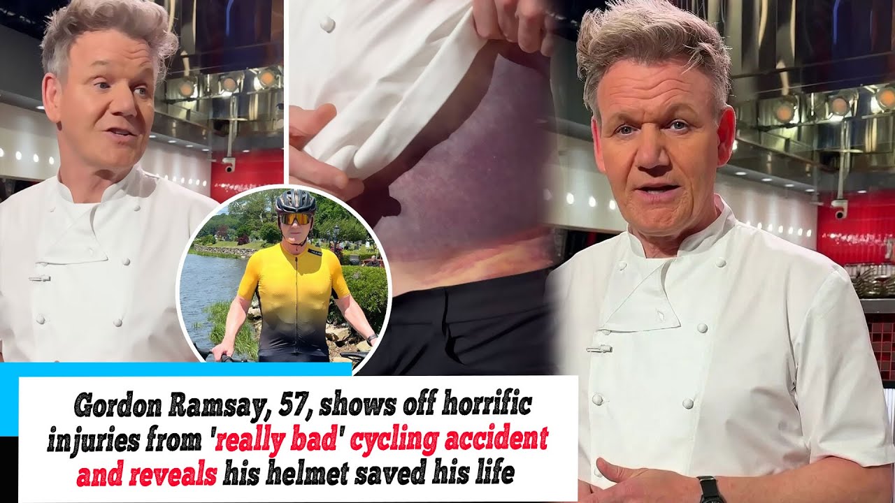 News: Gordon Ramsay, 57, shows off horrific injuries from 'really bad ...