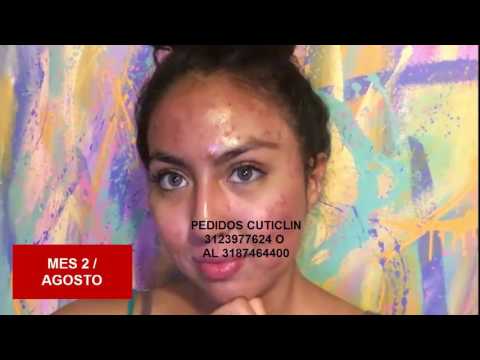 CUTICLIN, ISOFACE = ISOTRETINOINA VENTAS PARA TODA COLOMBIA - YouTube