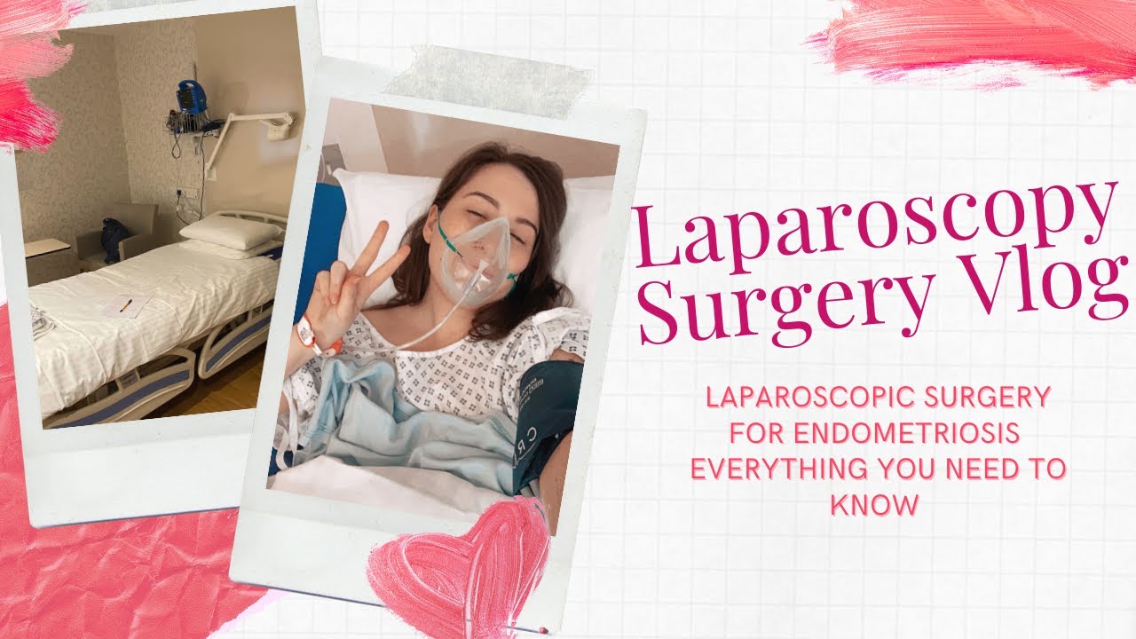 ENDOMETRIOSIS LAPAROSCOPY SURGERY VLOG WHAT TO EXPECT YouTube endometriosis-laparoscopy-surgery-vlog-what-to-expect-youtube