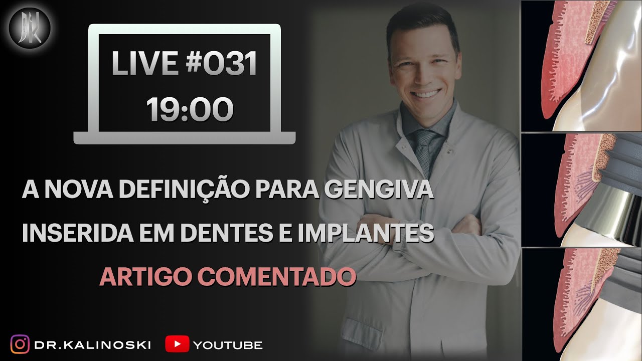 LIVE #031 - A NOVA DEFINIÇÃO PARA GENGIVA INSERIDA EM DENTES E ...