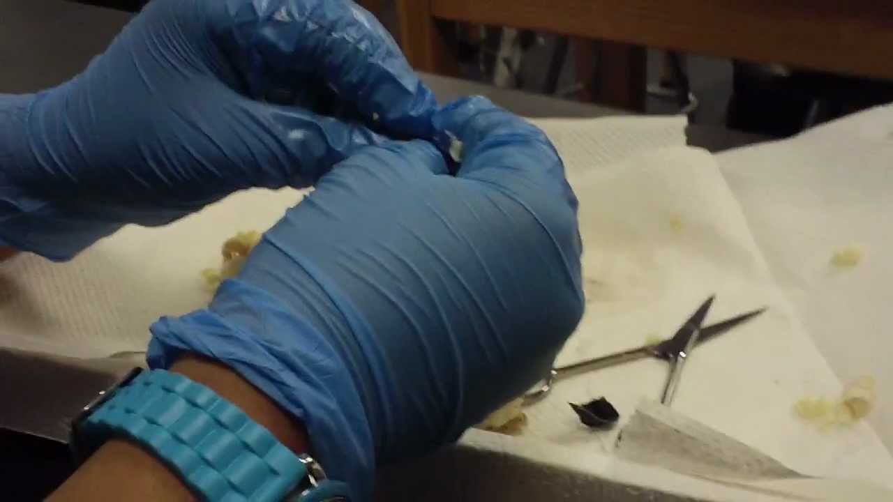 dissecting a goat eyeball - YouTube