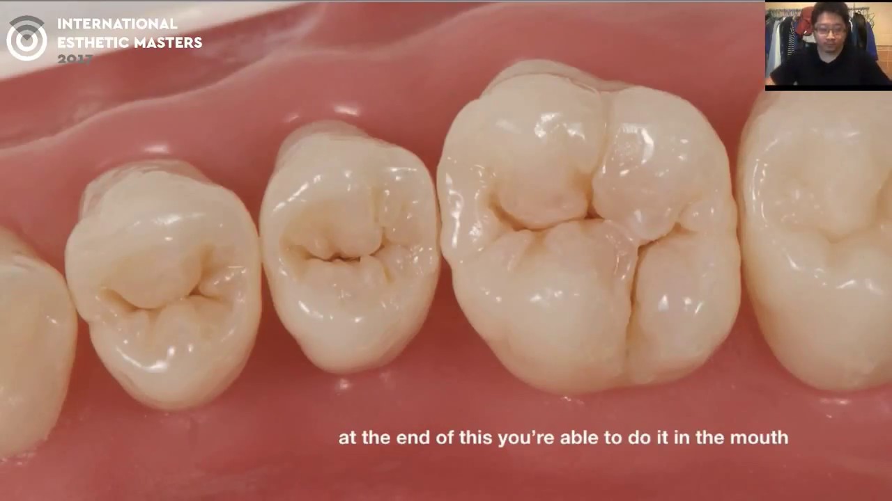 Esthetic Direct Composite Restorations - YouTube