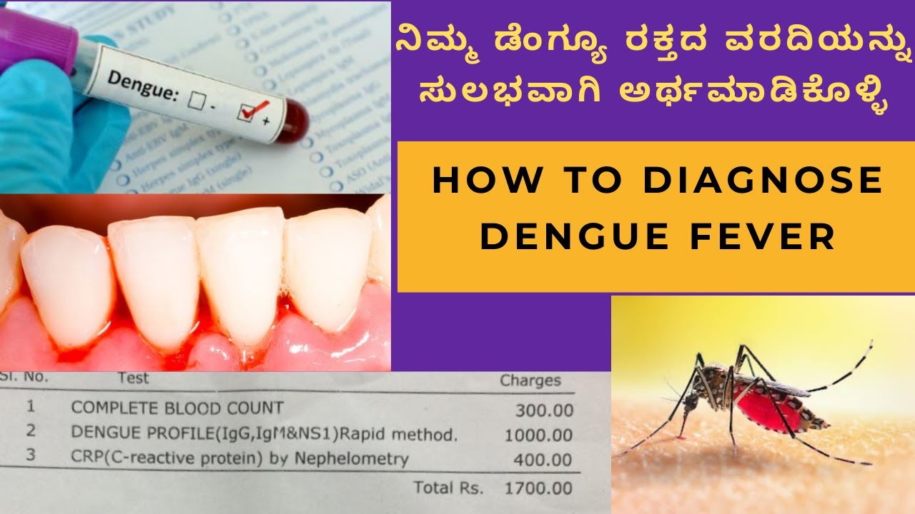 DENGUE FEVER DIAGNOSIS .BLOOD TEST FOR DENGUE ,COST ,REPORT ...