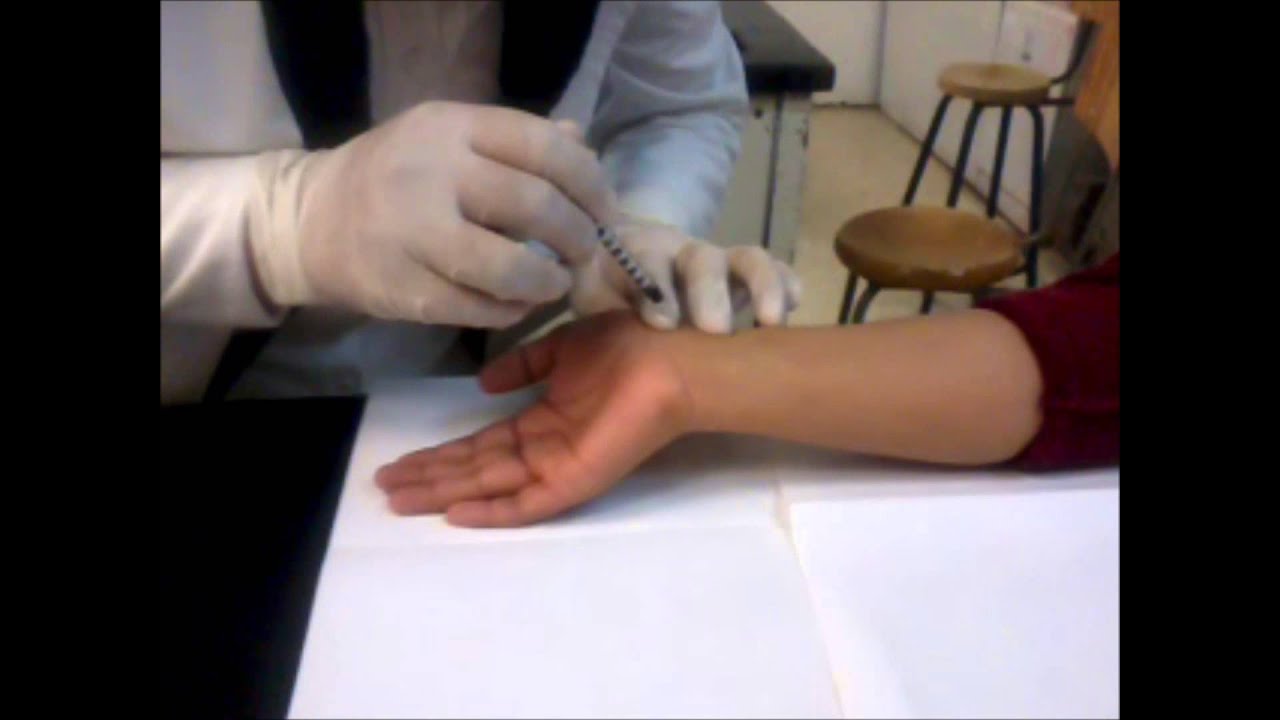 GASOMETRIA ARTERIAL - YouTube