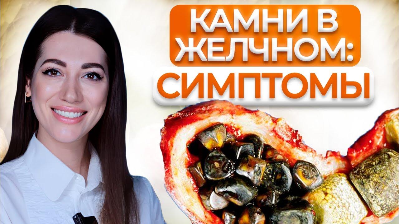 КАМНИ в ЖЕЛЧНОМ пузыре симптомы и методы диагностики Youtube