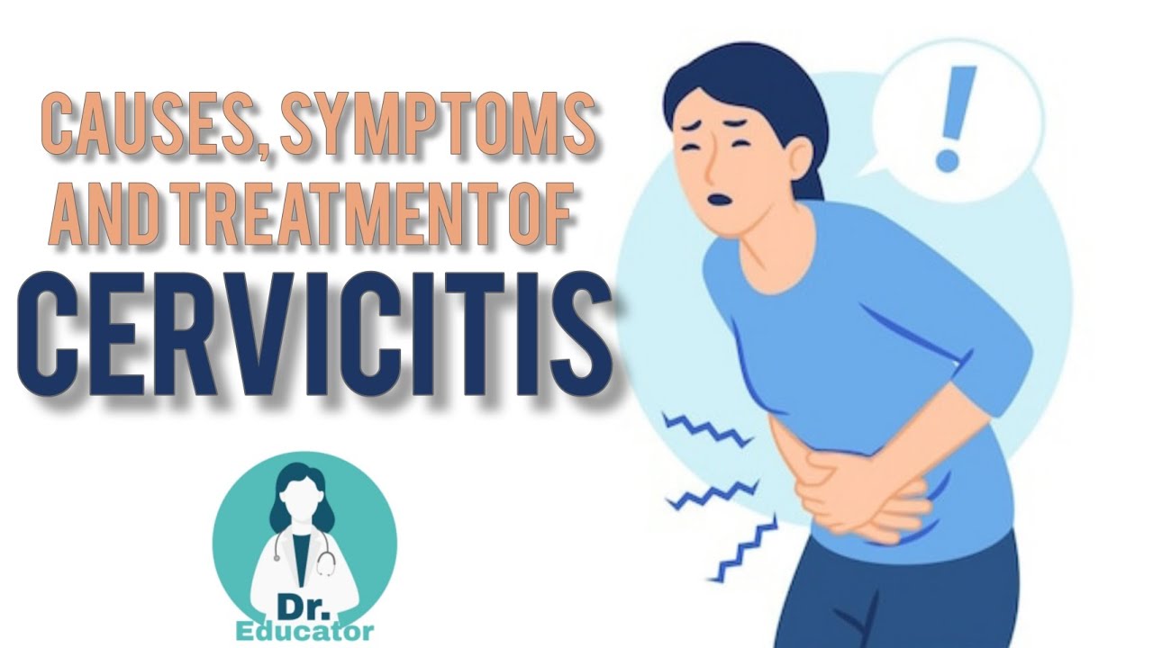 Cervicitis Unveiled | Symptoms | Causes and Effective Treatment ...