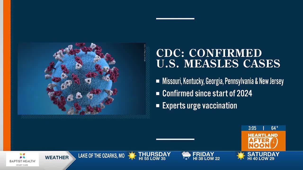 Preventing measles during U.S. outbreak feat. Autumn Grim - YouTube