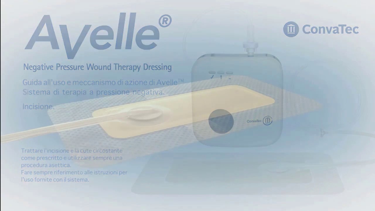 ConvaTec - AVELLE™ Sistema di terapia a pressione negativa- Incisioni Chirurgiche - YouTube