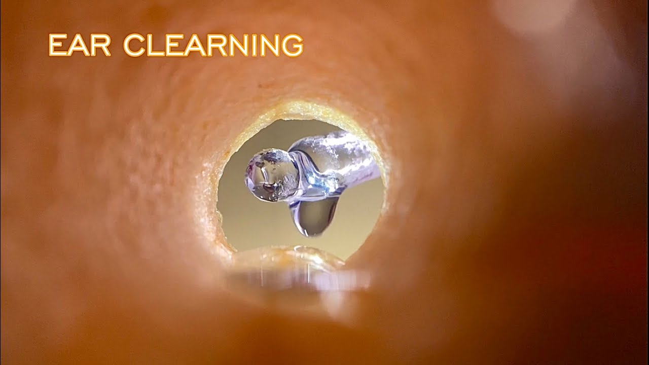 👂🏻ASMR EAR CLEARNING👂🏻 Ear peeling || Relaxing sounds💤💤💤 - YouTube