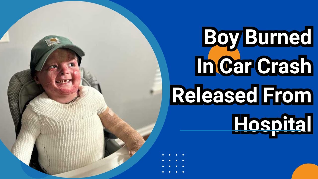 Boy Burned In Car Crash Released From Hospital - YouTube
