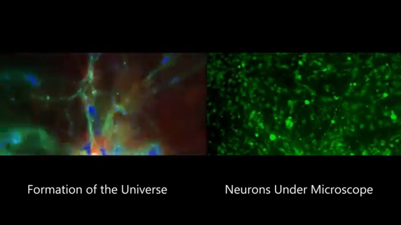 Brain Cells | The Universe - YouTube