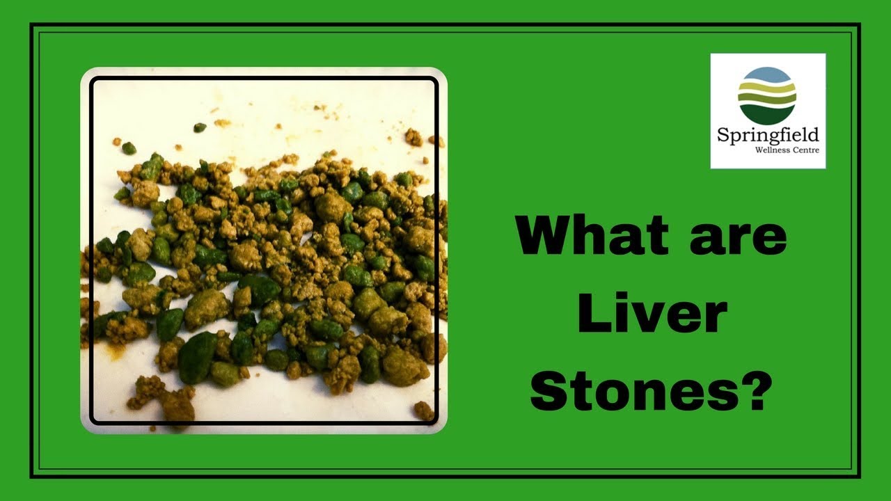 Dr Maran - What are Liver Stones - YouTube