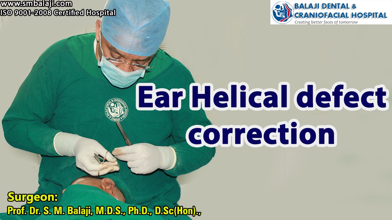 Ear Helical defect correction - YouTube