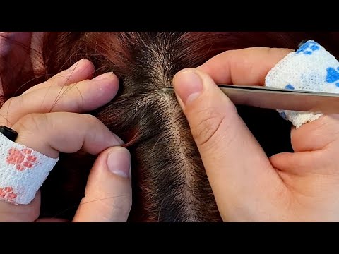 Gentle ASMR Scalp Care: No Talking, Soothing Dandruff Removal - YouTube
