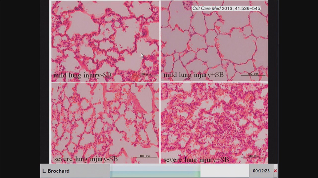 L. Brochard - PRO - INVASIVE VENTILATION: IS IT BENEFICIAL IN ARDS ...