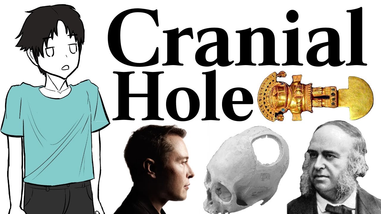 Trephination: Do you have a headache? JUST DRILL A HOLE IN YOUR HEAD ...