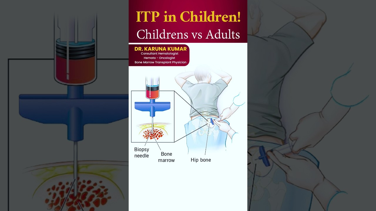 ITP in Children! | बच्चों में ITP! Childrens vs Adults#itp #platelets # ...