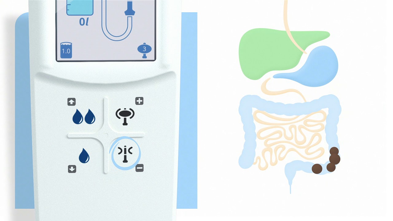 Navina Smart: Step-by-step - YouTube