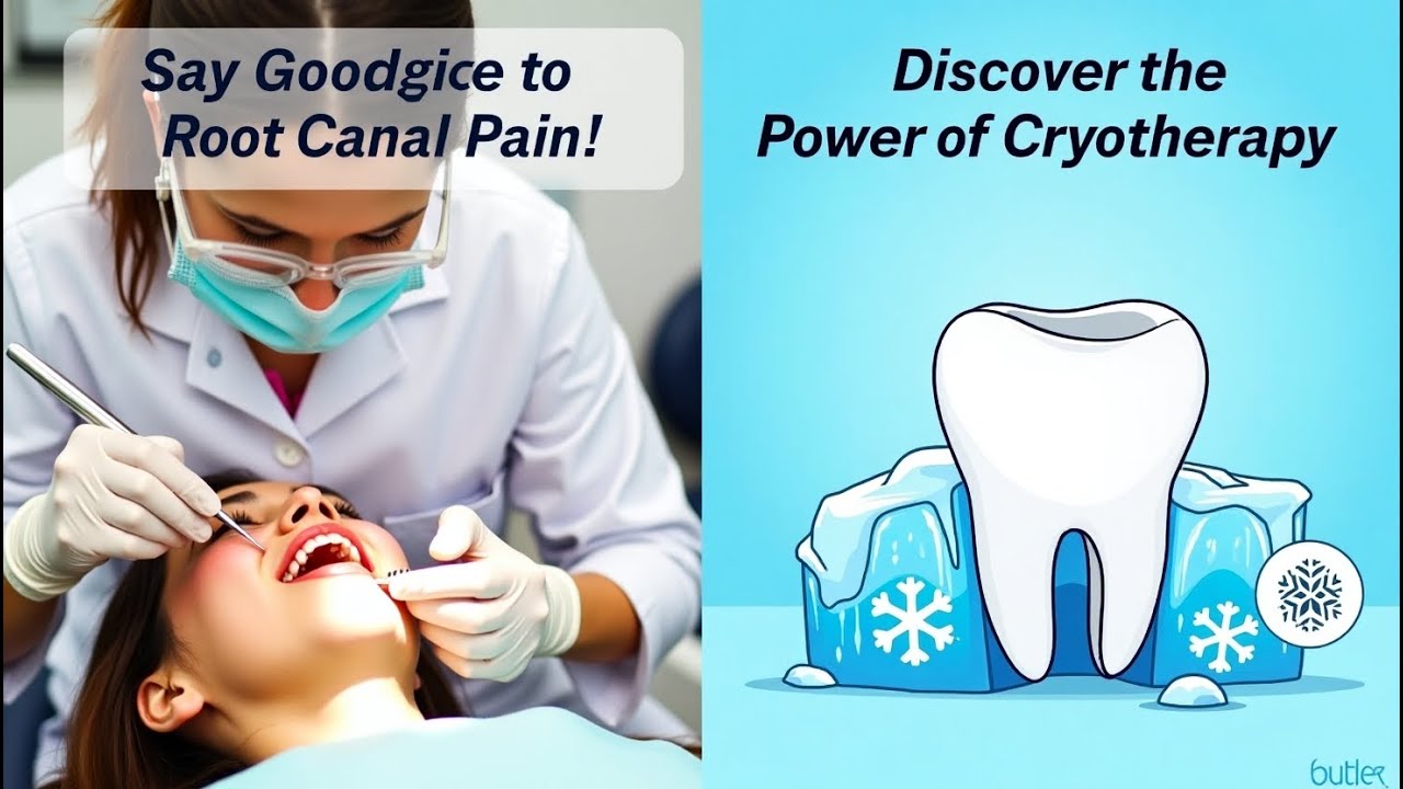 🦷 Say Goodbye to Post-Root Canal Pain with Cryotherapy! | Dental ...