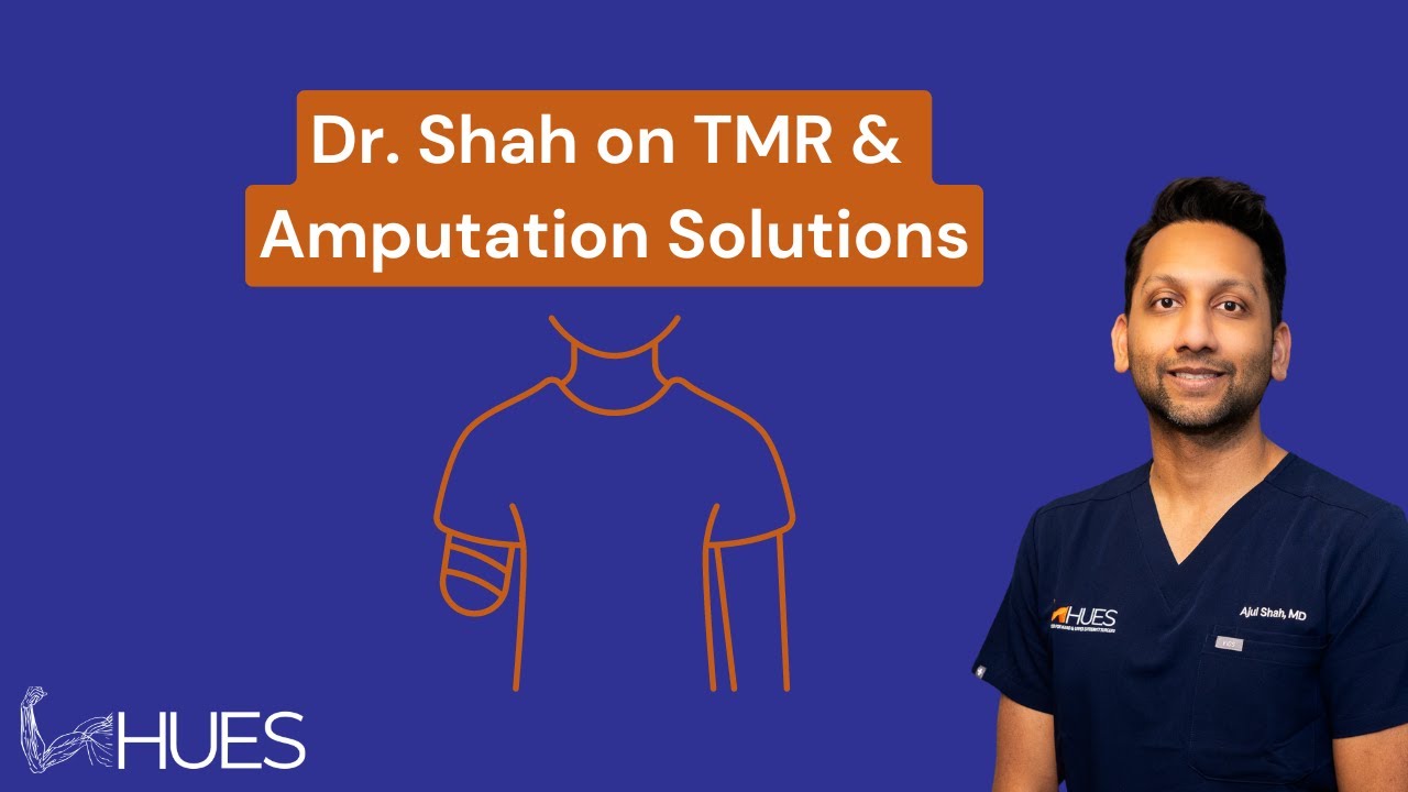 Dr. Shah on Amputation & Targeted Muscle Reinnervation (TMR): What You ...