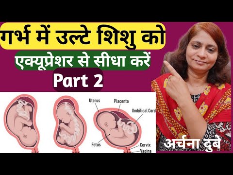 पेट में उल्टे बच्चे को सीधा कैसे करें / How to turn a breech baby ...