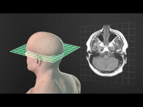 Anatomical Planes | Animated Tutorial