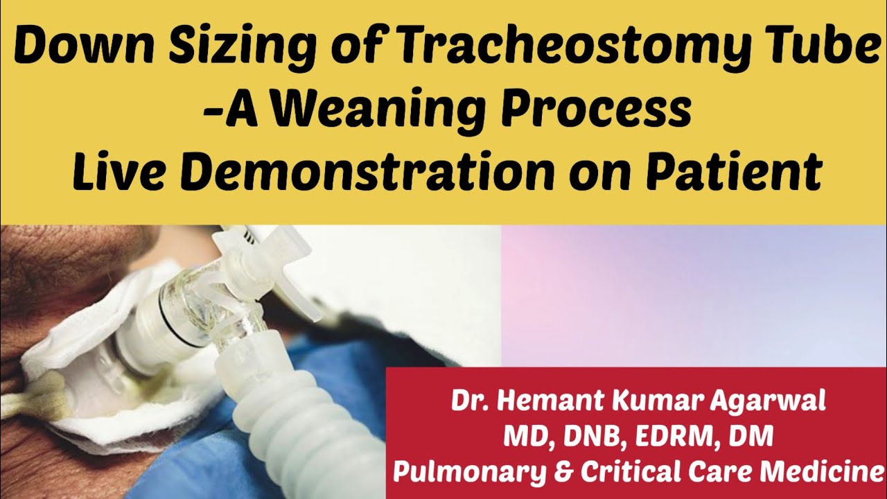 Down Sizing of Tracheostomy Tube- A Weaning Process - YouTube
