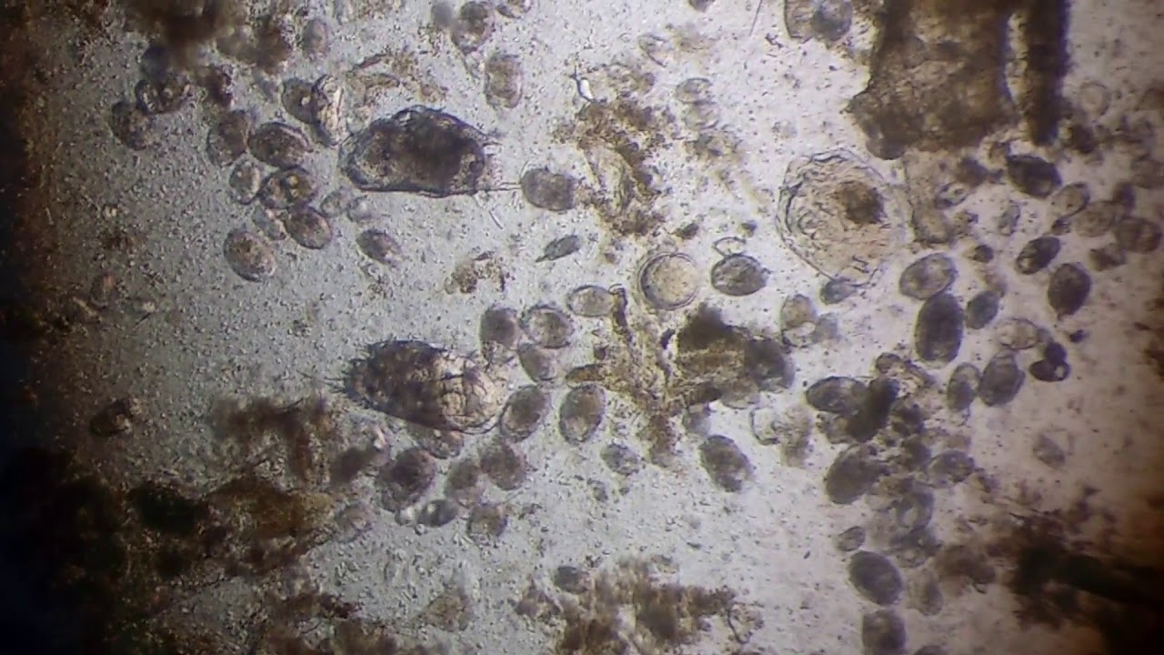 Observación de líquido ruminal - YouTube