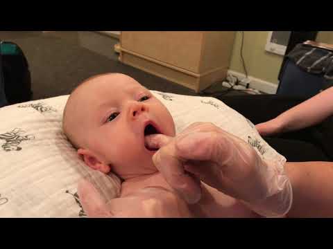 Gentle post-frenotomy care and mouth work by Melissa Cole, MS, IBCLC of Luna Lactation & Wellness
