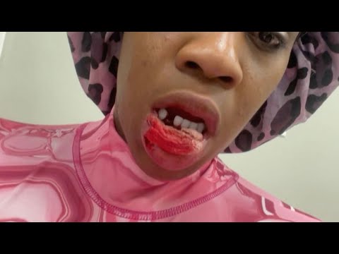 Teshki on live after the reunion talks abo… - YouTube