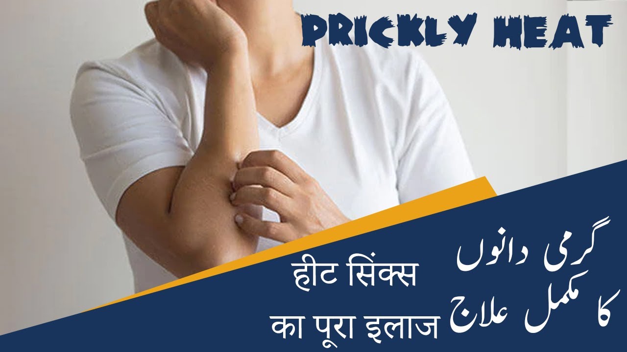 Homeopathic Medicine Prickly Heat Treatment Garmi Dano Ka Ilaj