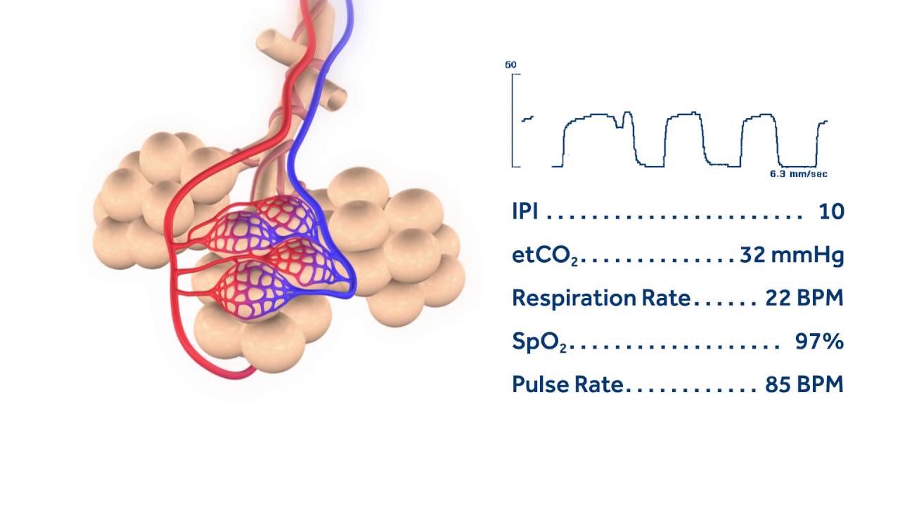 Medtronic Microstream Capnography In-Use Demonstration - YouTube