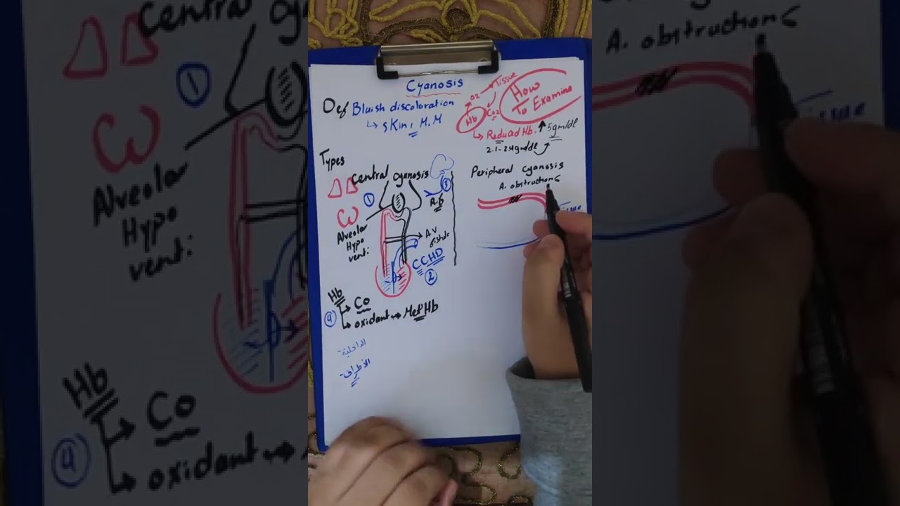 General Clinical Examination (general appearance 4 (Cyanosis, Jaundice ...