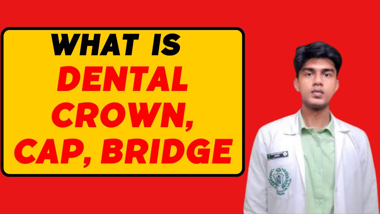 What is Dental Cap, Bridge, Crown used after Root Canal Treatment - YouTube