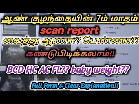 How To Find Baby Gender Using Scan Report BPD HC AC FL? //Baby Boy 7th ...