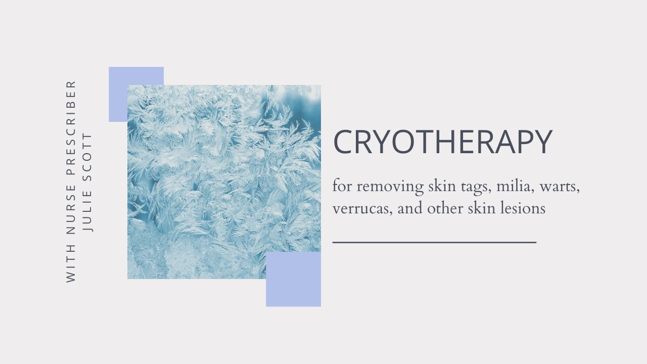 Cryotherapy: The Solution for Warts, Verrucas, Skin Tags, Sun Spots ...