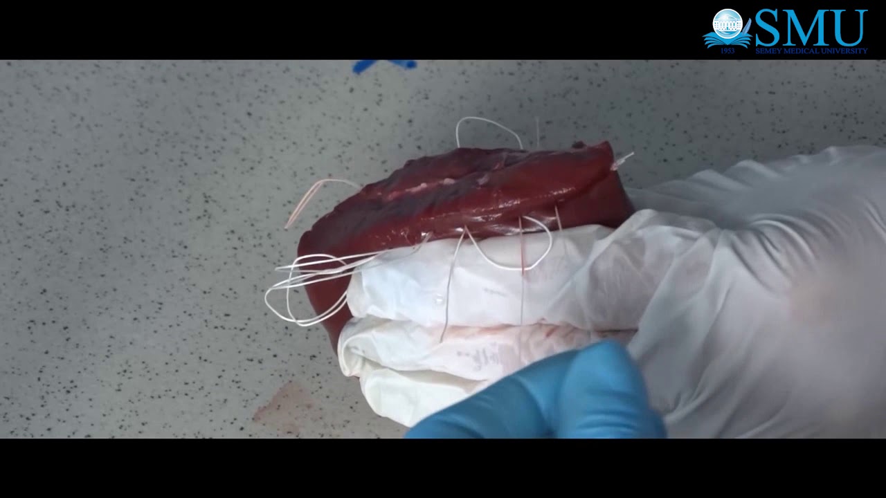 The technique of suturing Kuznetsov-Pensky on the liver - YouTube