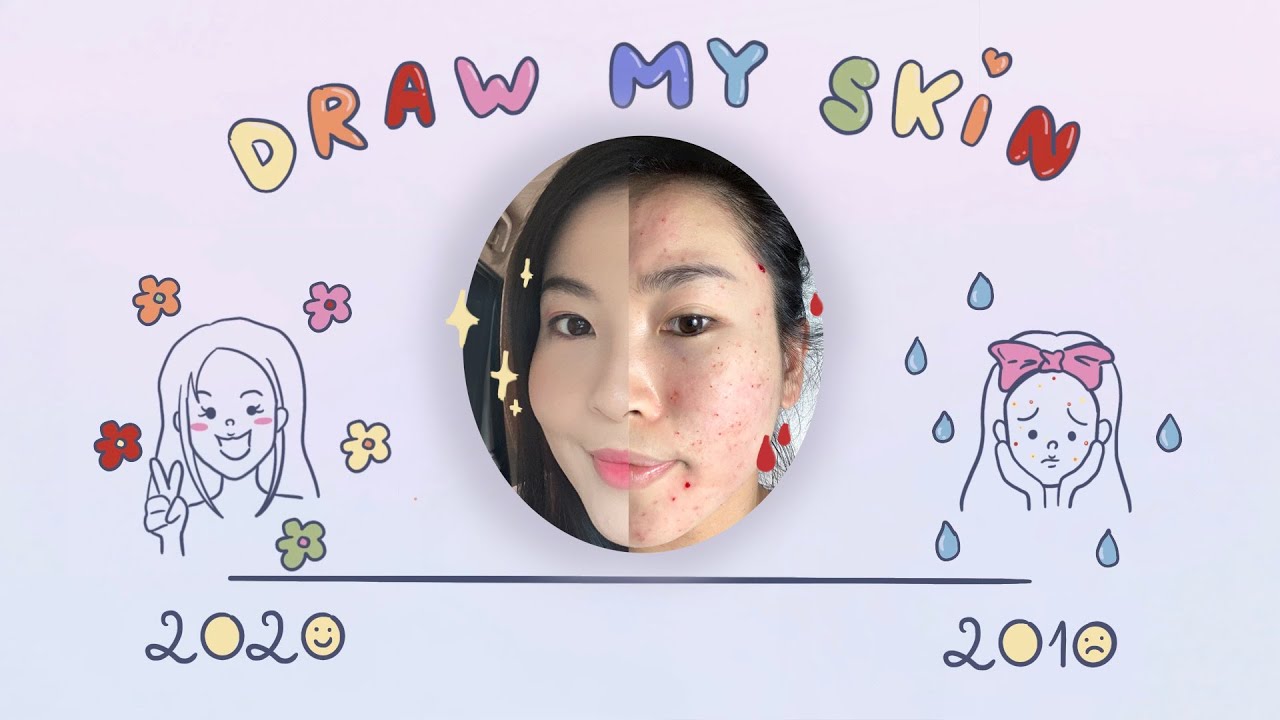 🖌 DRAW MY SKIN - Vẽ hành trình da mụn suốt 10 năm trời...😪 - YouTube