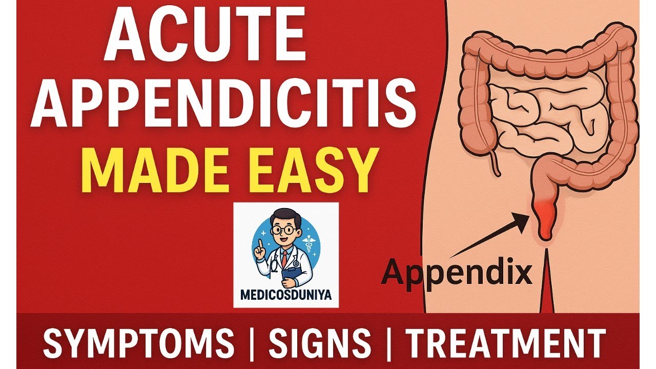 Appendicitis made easy | appendix ka ilaaz | appendicitis treatment ...